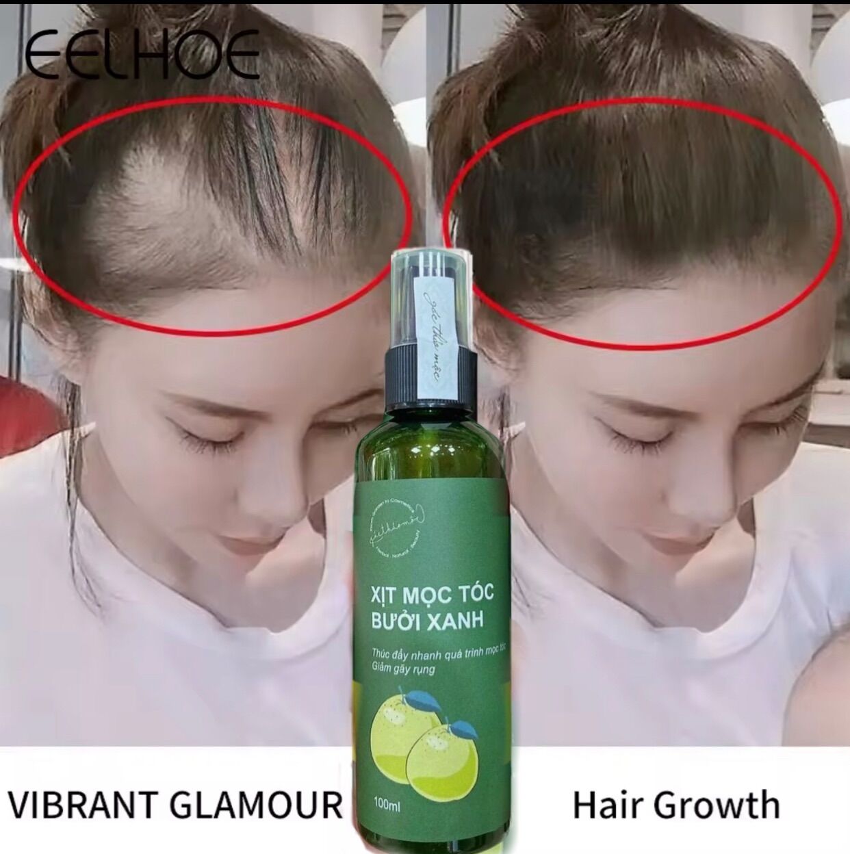 Xịt Mọc Tóc Bửi Xanh 100ml Kích mọc tóc con nuôi dưỡng nan tóc giảm gãy ...