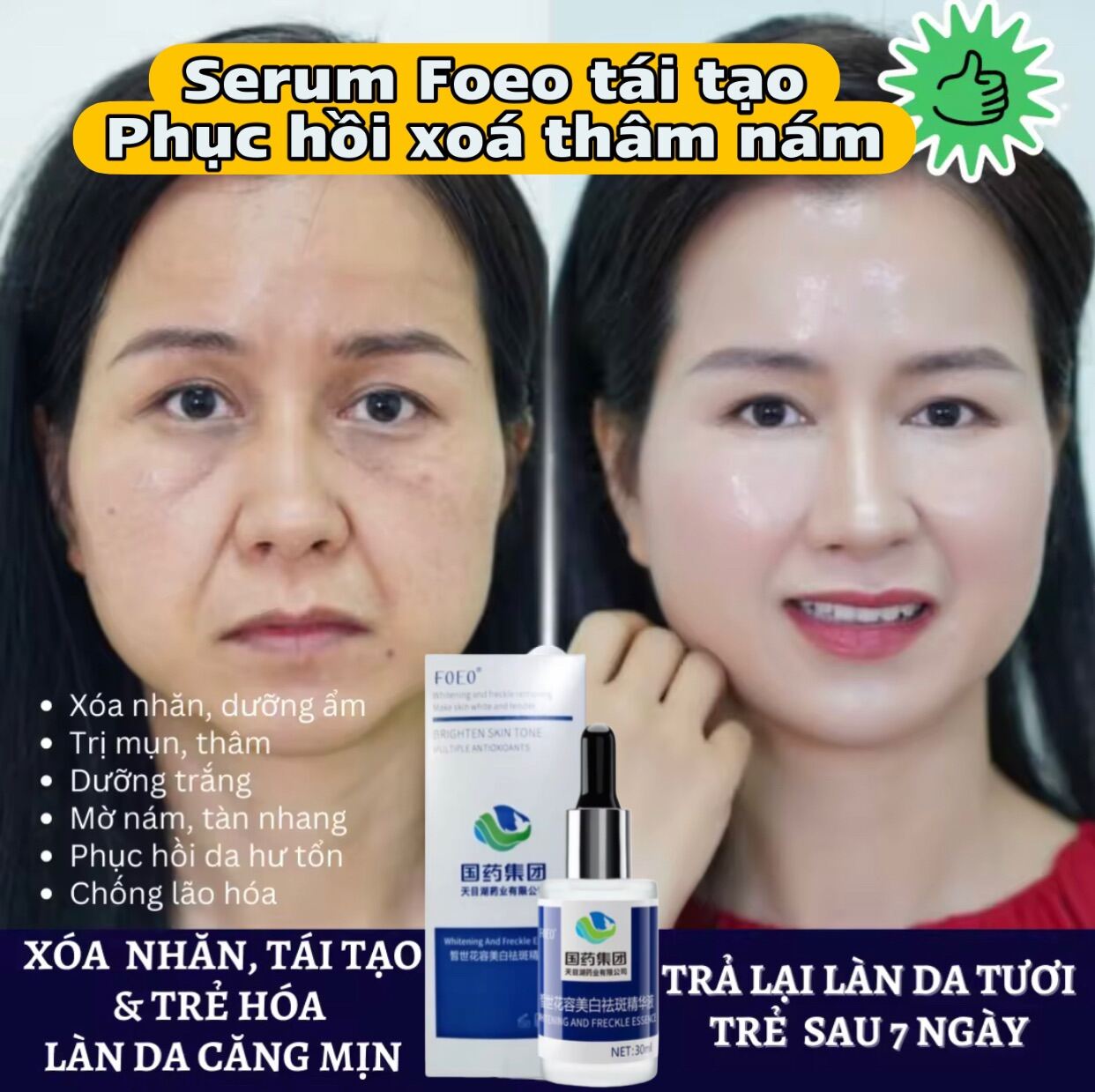 Serum Tế Bào Gốc Foeo 30ml (Hàng Chính Hãng) Tái Tại Phục Hồi Da Xoá ...